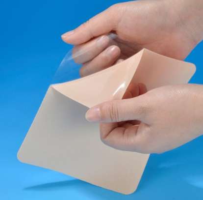 Silicone Gel Sheet for Keloid Scars: An Effective Solution for Scar ...