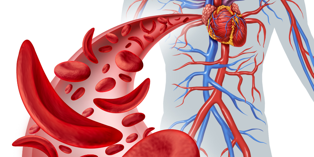 Understanding Symptoms of Poor Blood Circulation in Legs: Identifying ...